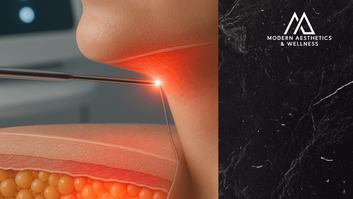 iLaser 1940 - An Innovative and Powerful Skin Tightening Treatment